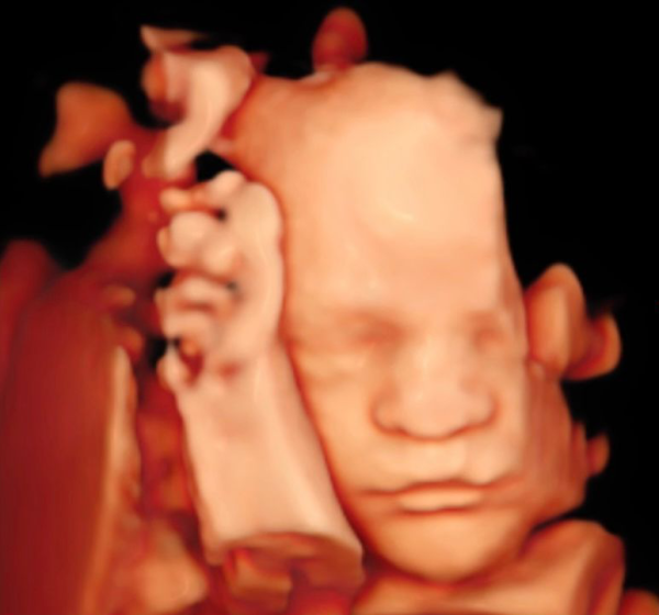 3D, 4D en 6D echo | Uniekgeboortezorg.nl